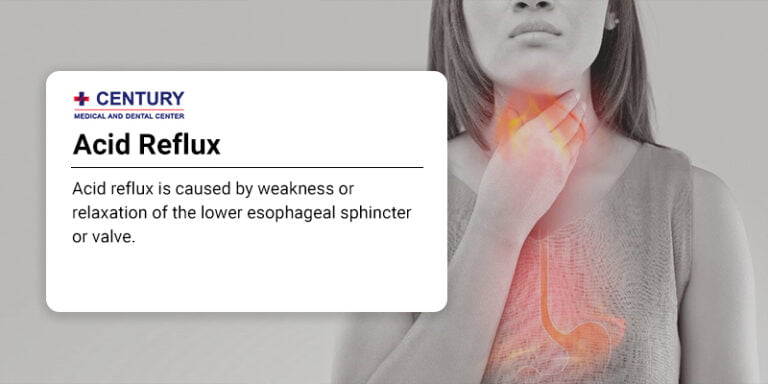 7 Symptoms Of Acid Reflux - Century Medical & Dental Center