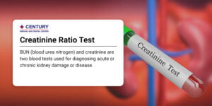 About Our BUN/Creatinine Ratio Test - Century Medical & Dental Center
