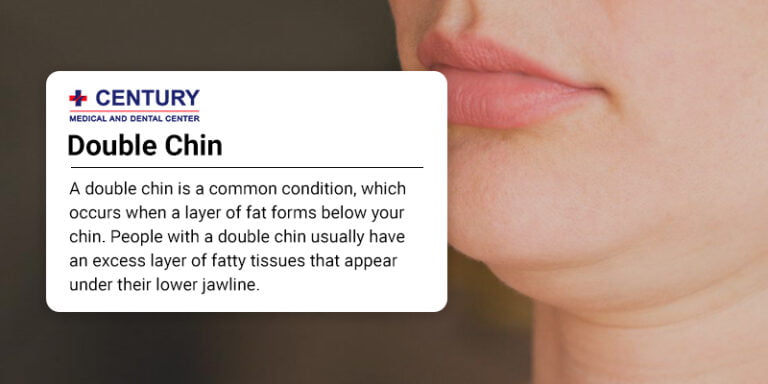 ¿Quieres eliminar la papada? Aquí hay cinco maneras de hacerlo ...