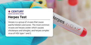 4 Reasons Not to Freak Out About Your Positive Herpes Test - Century ...