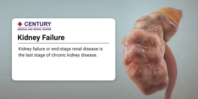 What Is Stage 3 Kidney Failure? - Century Medical & Dental Center