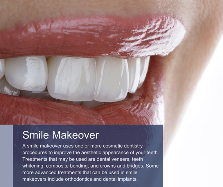 Smile Makeover Midtown Manhattan and Downtown Brooklyn | Smile Makeover ...