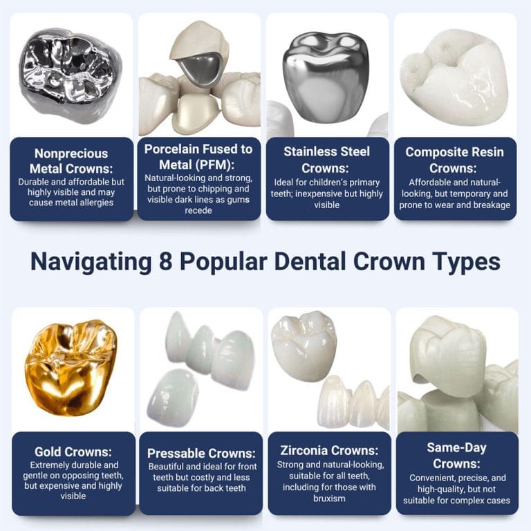 Navigating 8 Popular Dental Crown Types | Century Medical & Dental Center