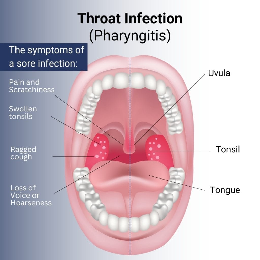 Throat Infections Treatment in NYC (Brooklyn, Manhattan, Harlem) | Century Medical & Dental Center